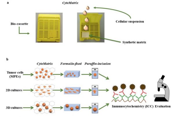 Cytomatrix – La nuova frontiera della citologia